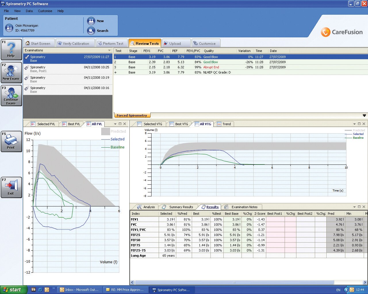 Care Fusion Spirometry PC Software RES129 - Henry Schein - UK