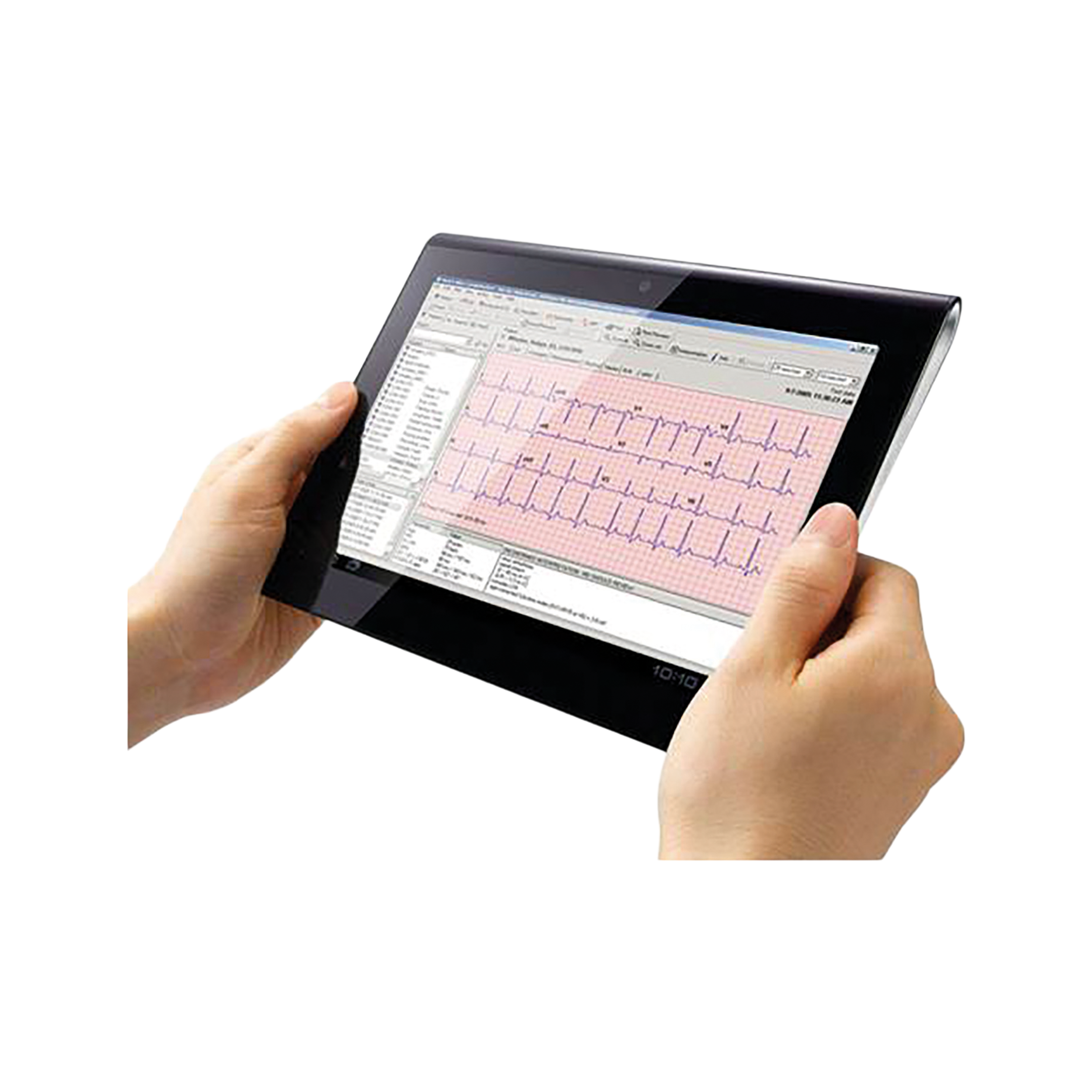 Welch Allyn Upgrade Cardioperfect W Station 2002 or Later ECG60004 ...