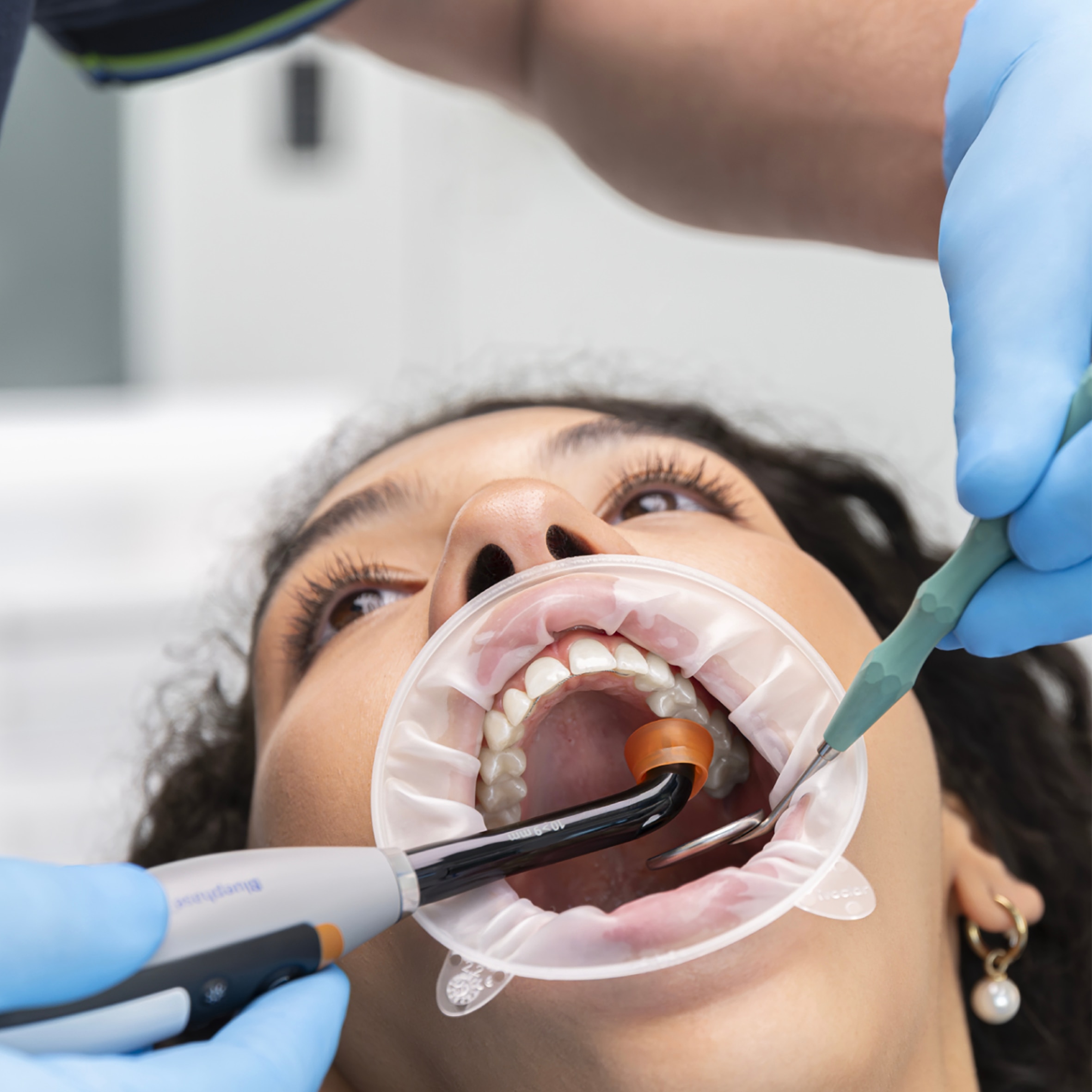 Ivoclar Optragate 2 Assortment Kit 1214757 - Henry Schein - UK